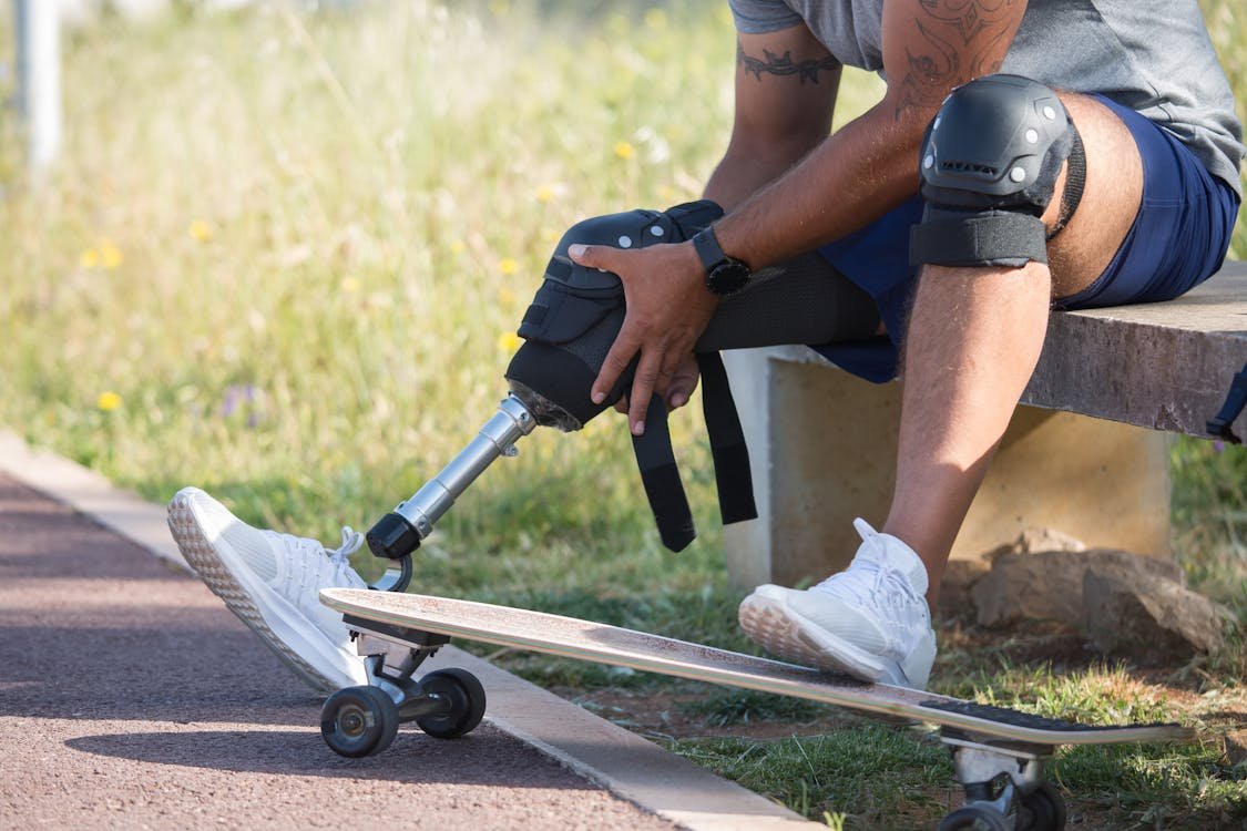 How a Poorly Fitted Prosthetic Can Cause Pain and Long-Term Damage